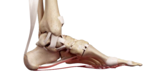 Talalgie, comment la soulager efficacement ? - New Equilibre